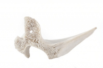 Knochengeweberemodellierung (Knochenumbau) - Funktion, Aufgabe ...